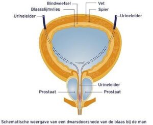 Blaaskankertypes en anatomie van de blaas - Stichting tegen Kanker