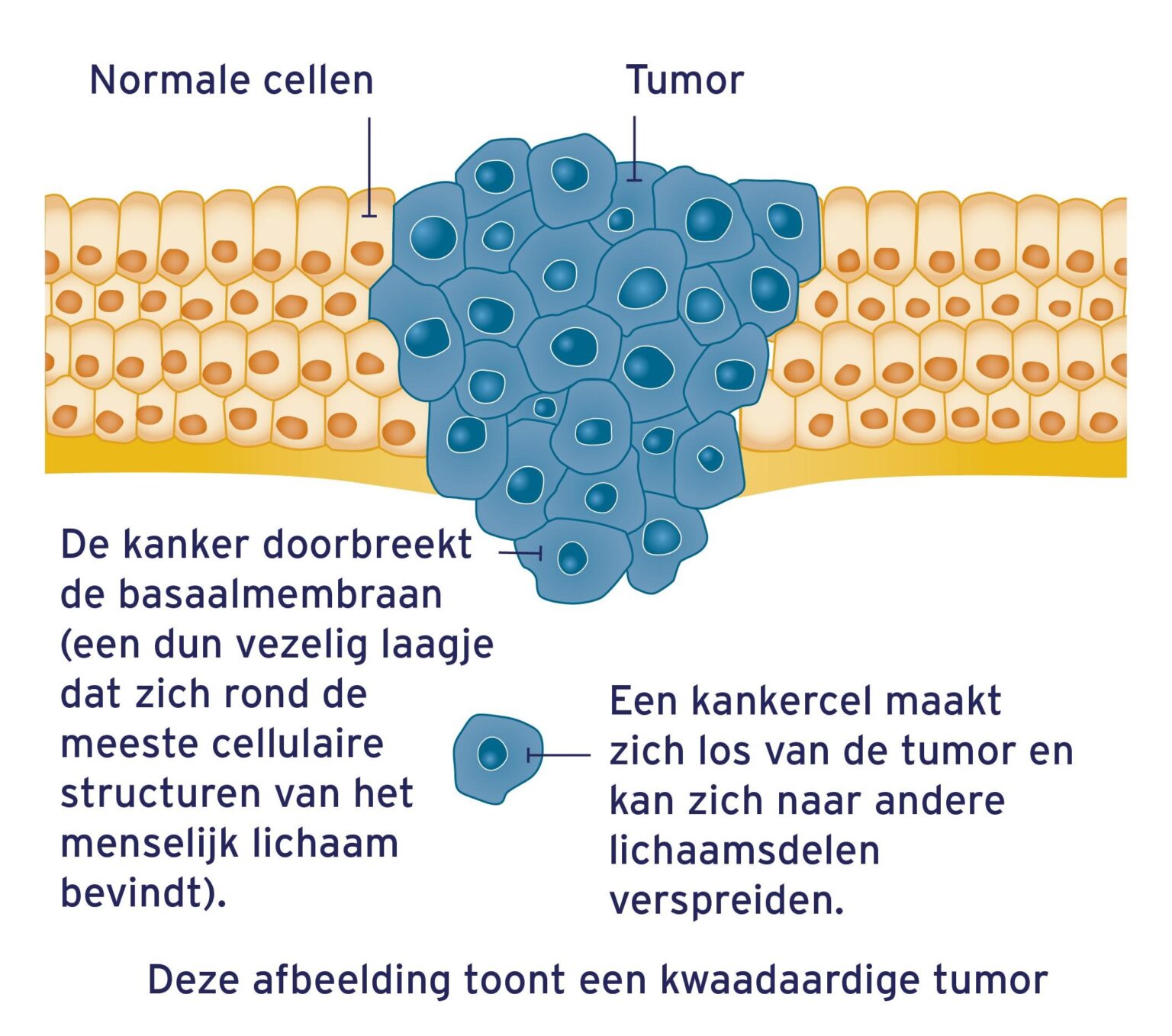 Hoe wordt een tumor gevormd? - Stichting tegen Kanker